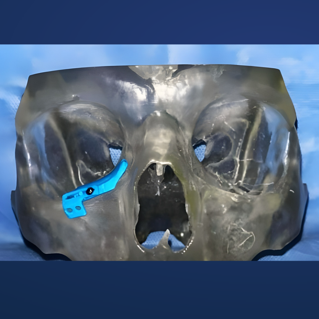CI MED Students Create New Tool to Improve Eye Trauma Surgeries | Carle ...