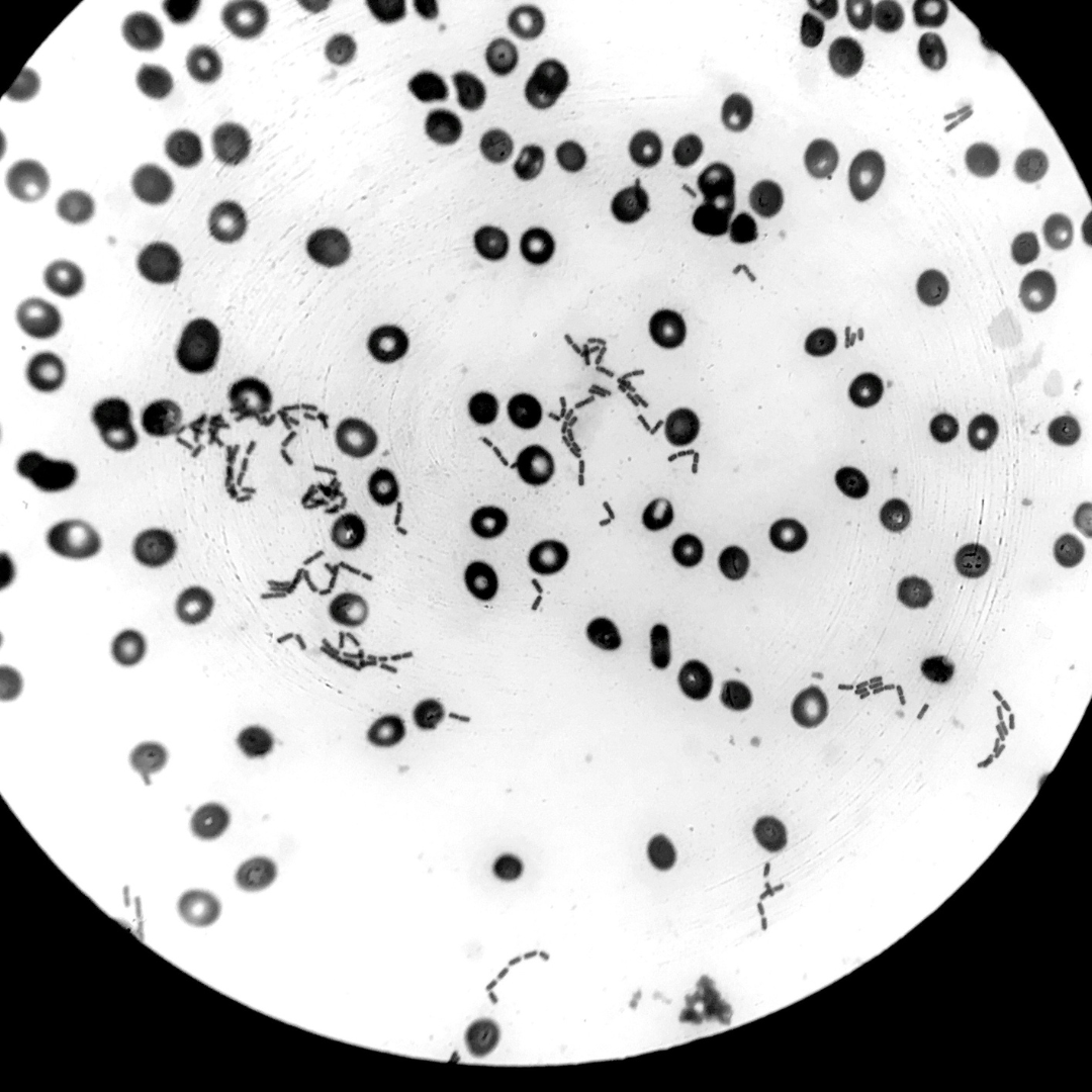 Creating Better Blood-Infection Diagnosis | Carle Illinois College of ...