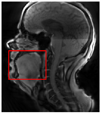 Crunching the Data: MRI-Powered Research Maps the Brain's Role in ...